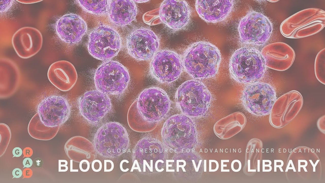 Treatment Options for Relapsed Diffuse Large B-Cell Lymphoma Blood ...
