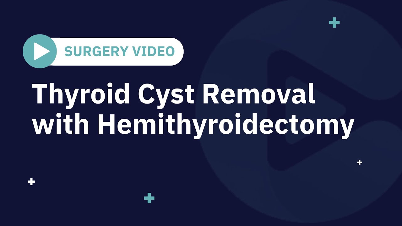 Surgery Video: Thyroid Cyst Removal with Hemithyroidectomy - YouTube