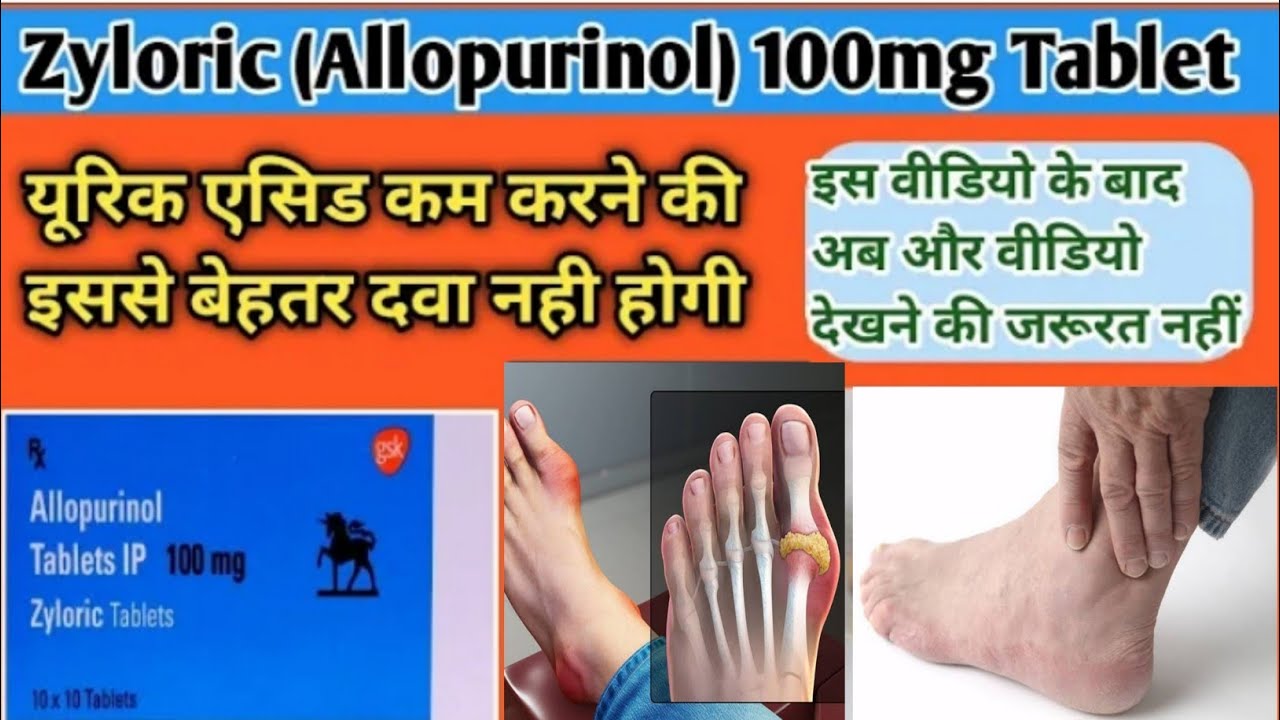 Xyloric 100 Mg Tablet Use Dose Side Effects In Hindi #gout - YouTube