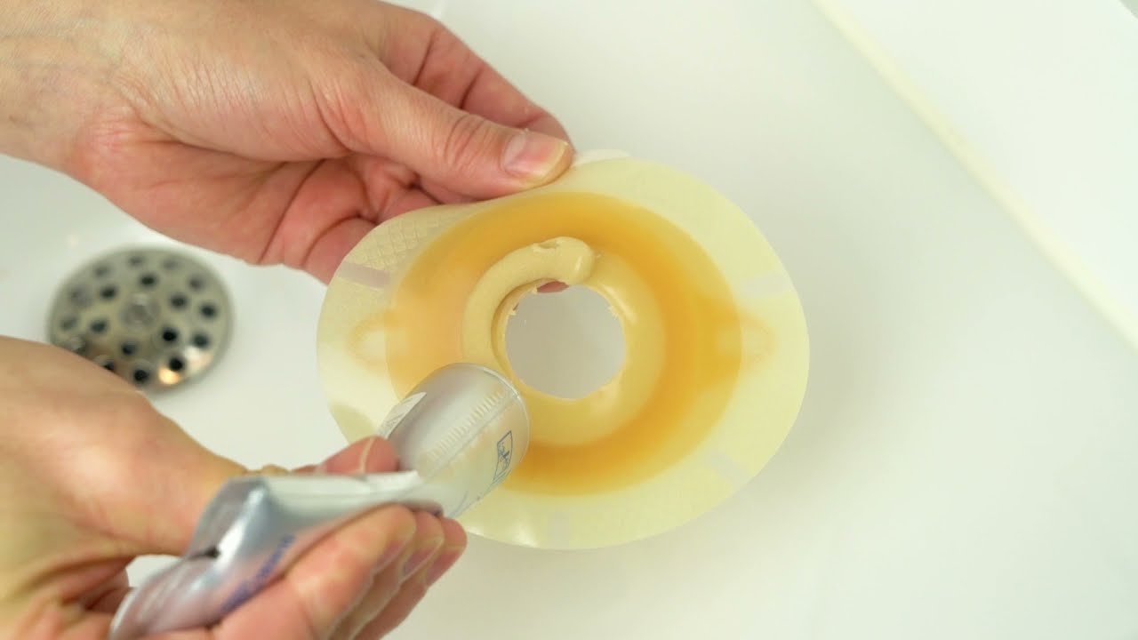 Anpassen der Stoma-Basisplatte (2-teiliges System), Schritt-für-Schritt ...