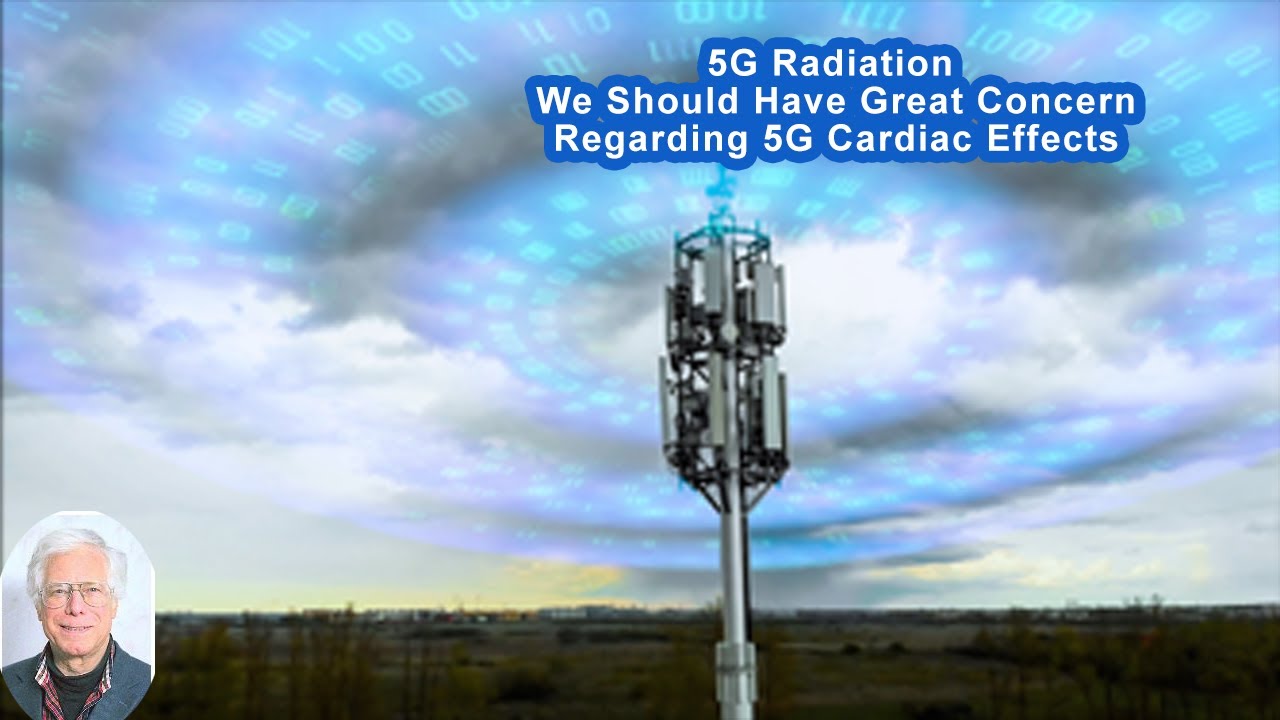 Observations About 5G Radiation Effects In Humans Suggest That We ...