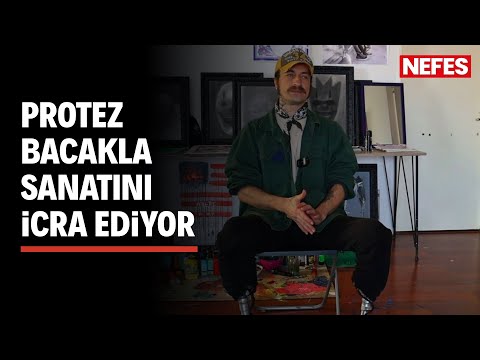 Bacaklarını kaybeden grafiti sanatçısı protezlerle yeni hayatına tutundu