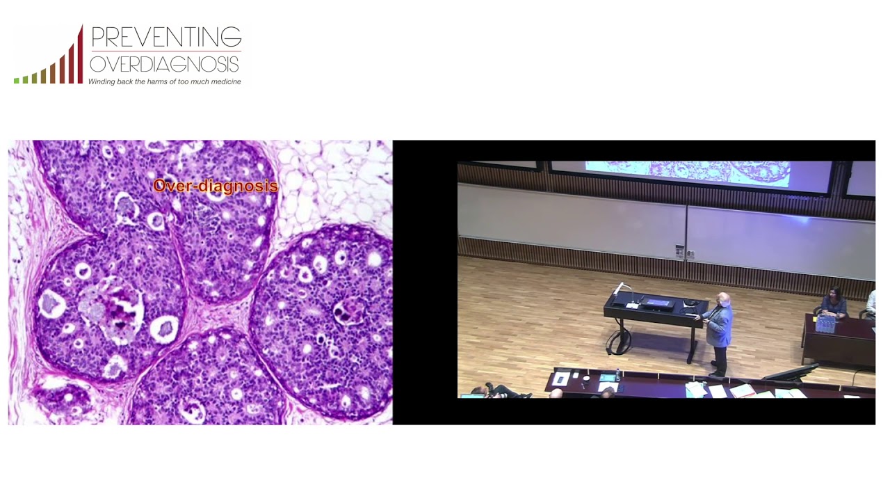 Michael Baum - De-implementation of breast cancer screening programmes ...