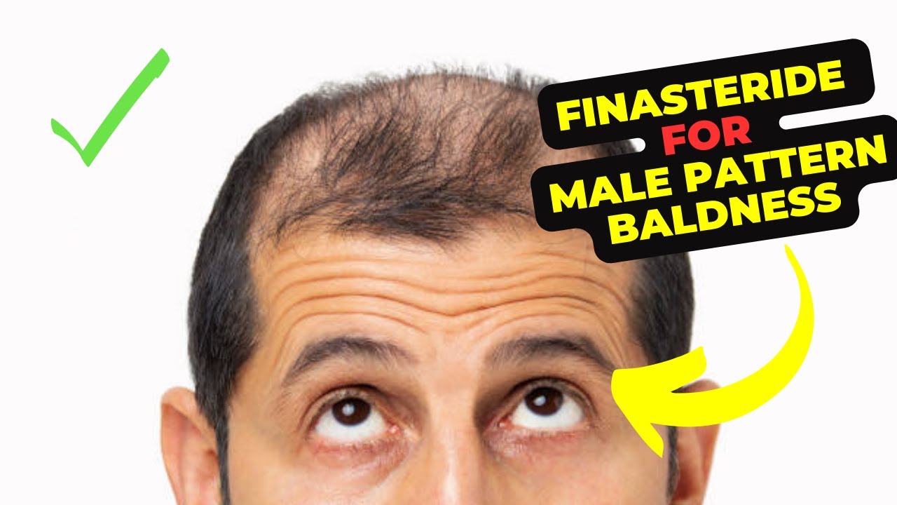 Finasteride: Dosage, Side Effects, and Topical Application Insights ...