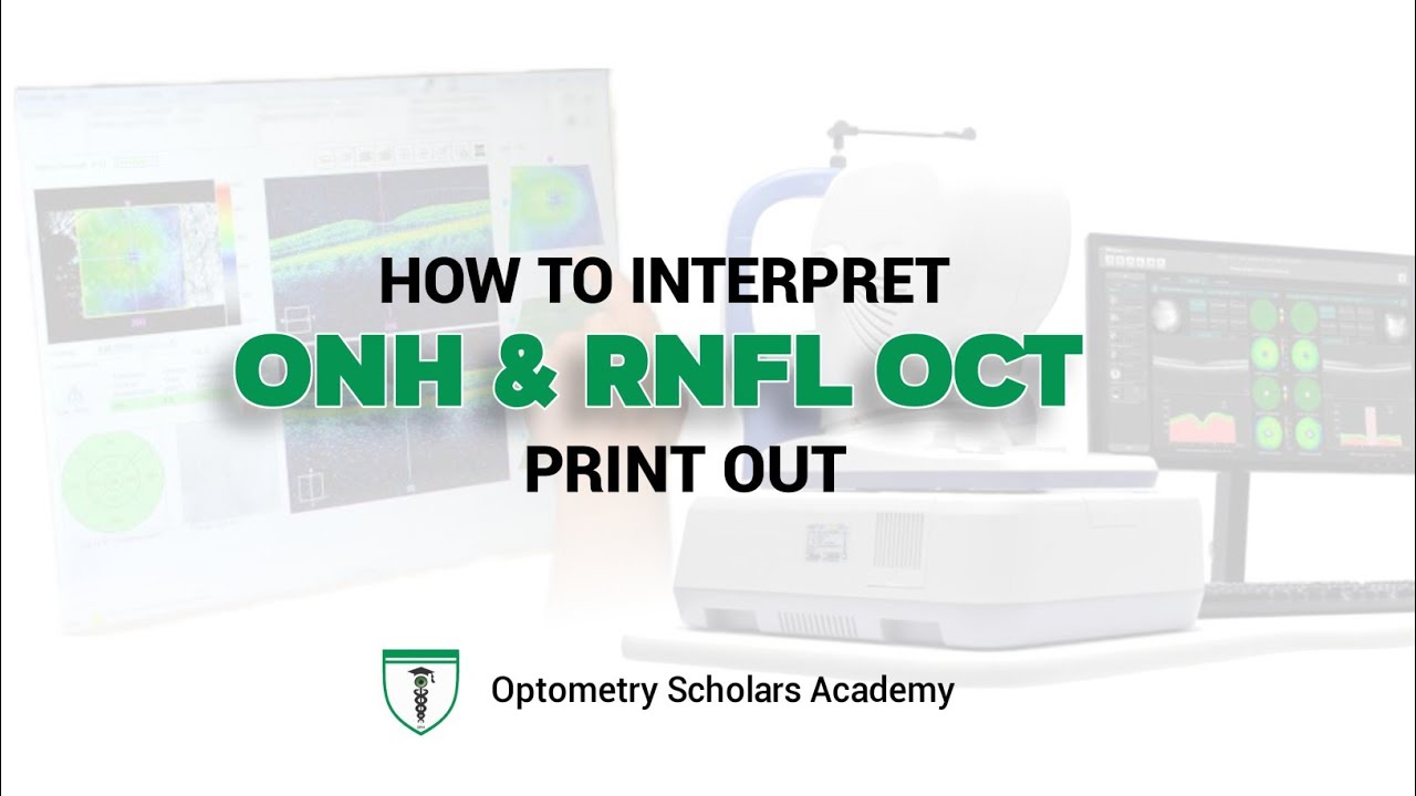 How to interpret ONH & RNFL OCT print out. - YouTube