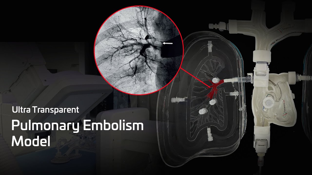 Ultra-Transparent Pulmonary Embolism Model |Thrombectomy Device ...