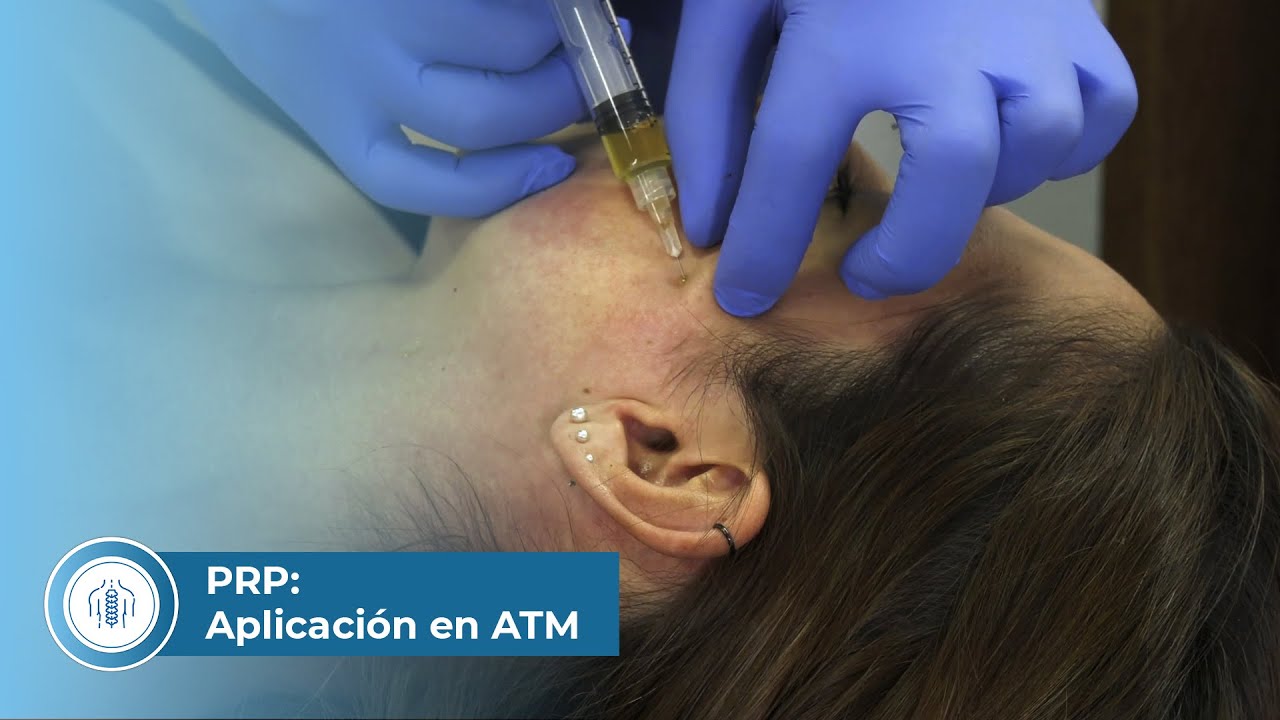 Plasma Rico en Plaquetas: Aplicación en ATM - YouTube