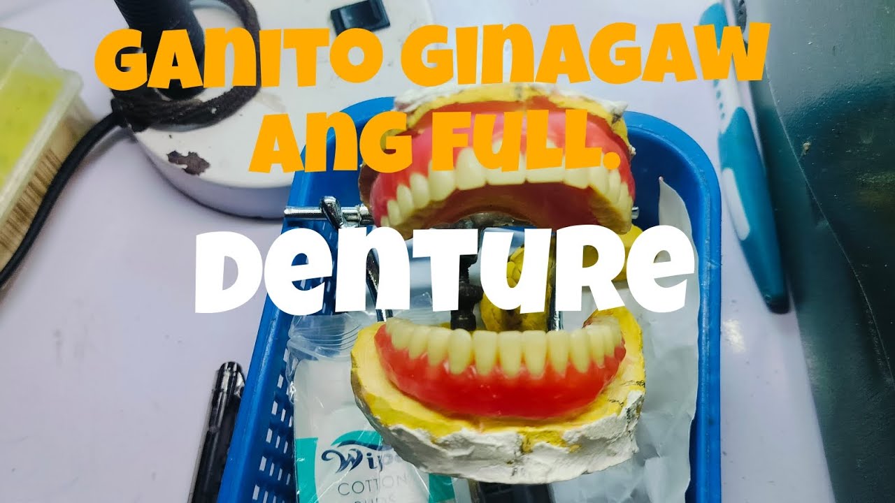 denture.ganitopala.ginagawa ang pustiso.full video.. - YouTube