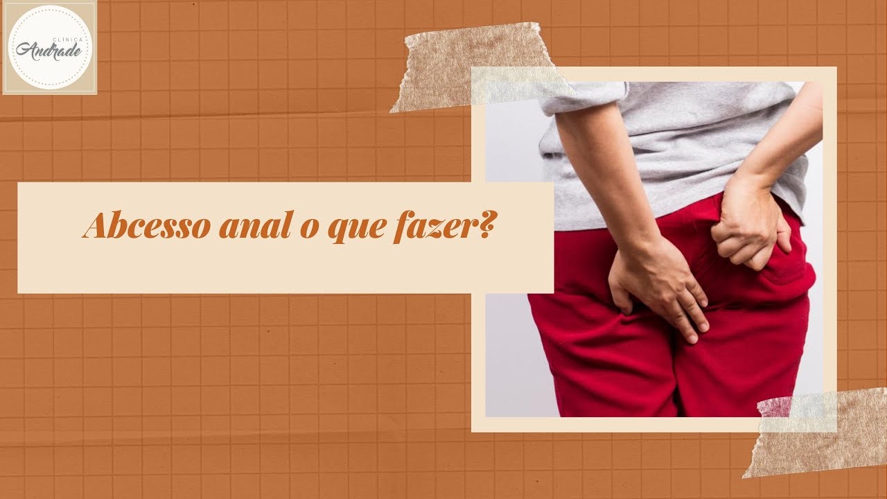 ABCESSO ANAL O QUE FAZER ? | DRA. ESTHER ANDRADE - YouTube