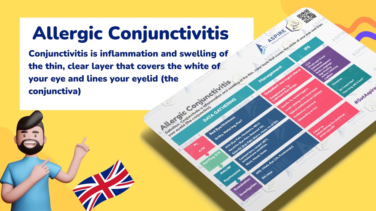 Allergic Conjunctivitis - Ophthalmology - YouTube