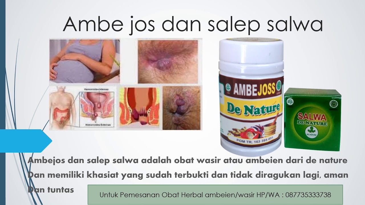 Operasi Ambeien - YouTube