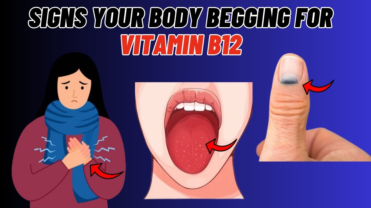 Symptoms of Low B12 | Vitamin B12 Deficiency Symptoms | B12 Deficiency ...