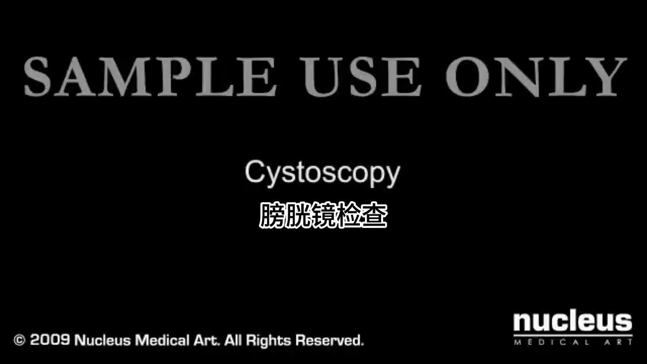 The whole process and purpose of cystoscopy - YouTube