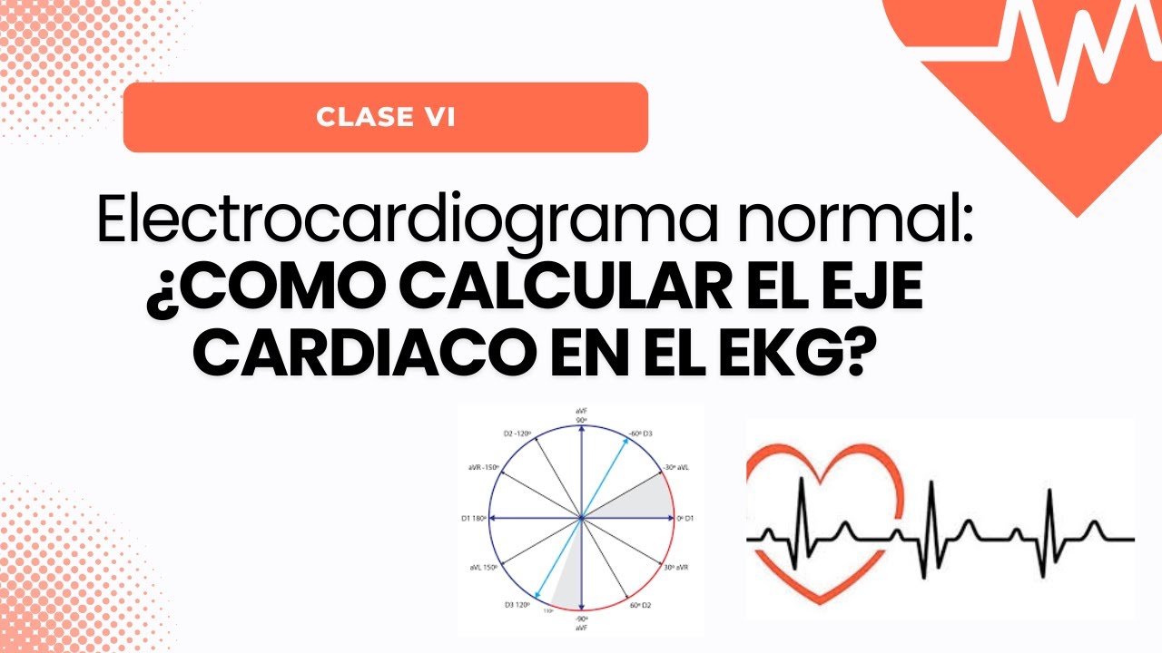 Electrocardiograma normal: EJE CARDIACO, EJEMPLOS Y FORMAS DE ...
