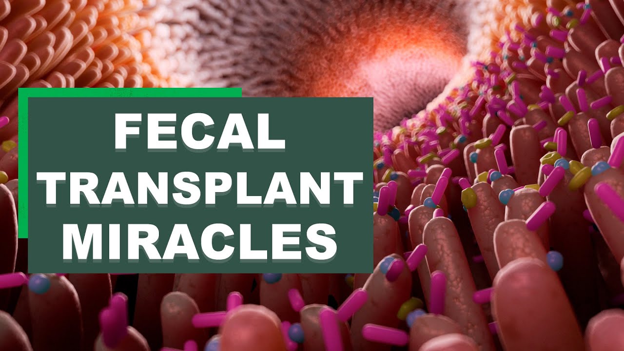 Miraculous fecal transplants? 💩 Microbiome and gut expert, Dr James ...