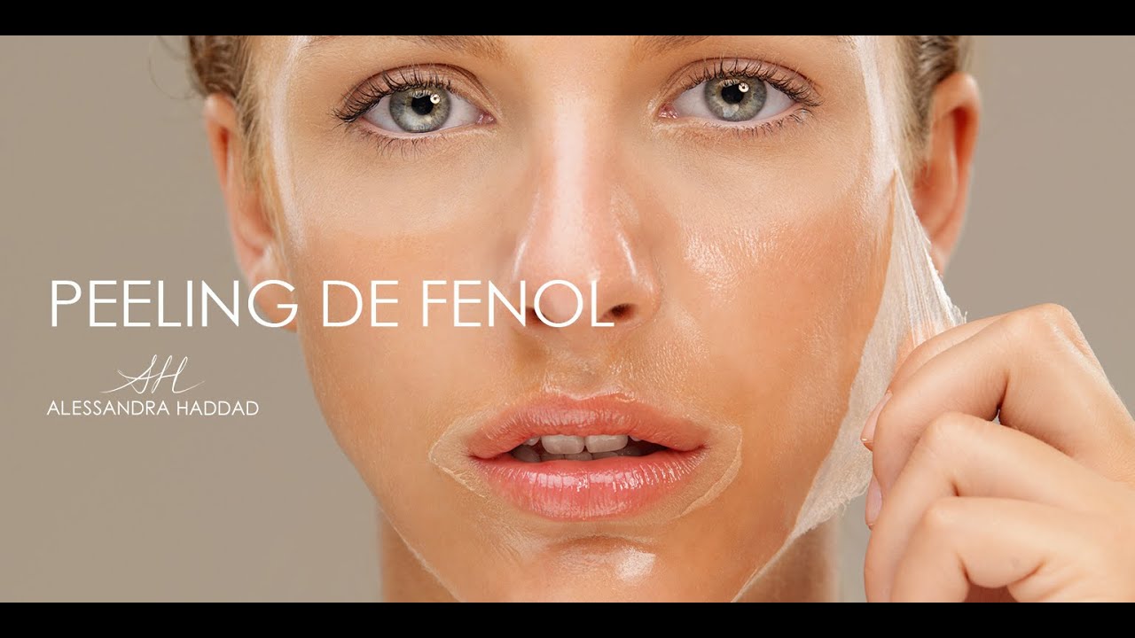 Peeling de Fenol - YouTube