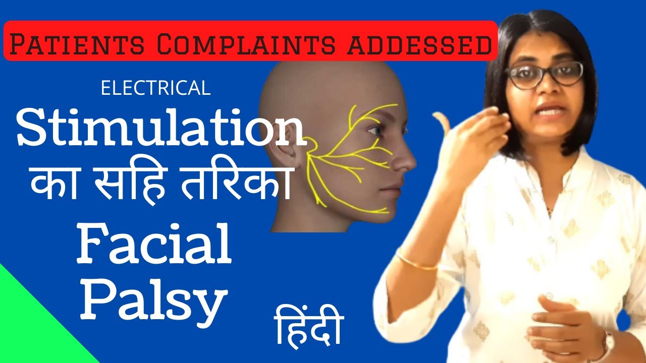 Electrical Muscle Stimulation for Facial Palsy in Hindi | Stimulation ...