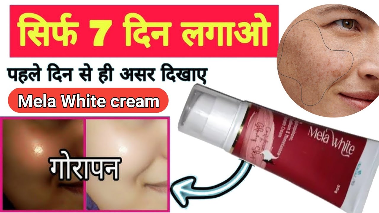 Mela white cream || how to use skin care cream || गोरे होने की क्रीम ...