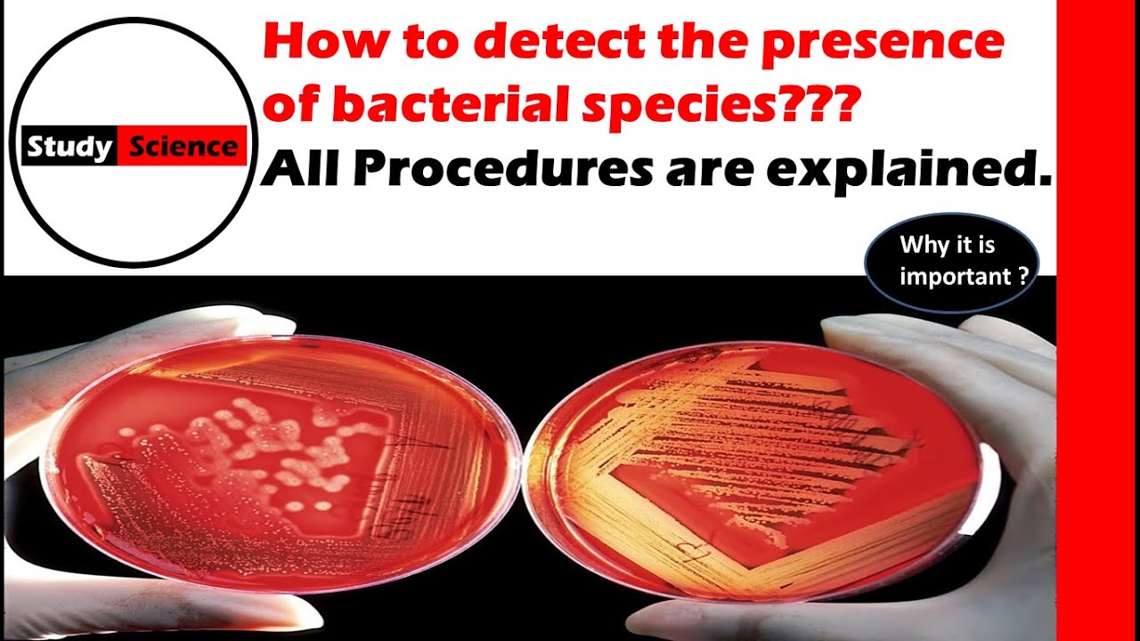Bacteria Identification. How to find Bacteria Video? Detect presence of ...