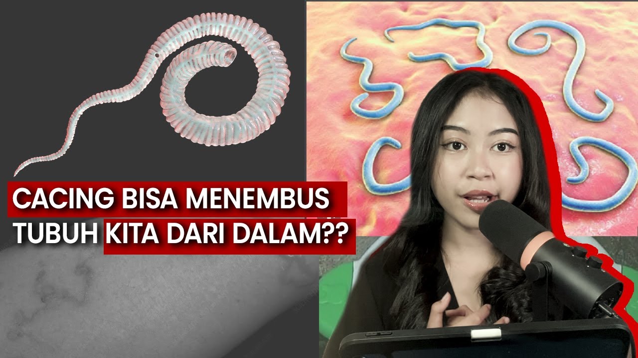 Cacing Guinea: Parasit Menakutkan yang Bisa Tumbuh Hingga 1 Meter di ...