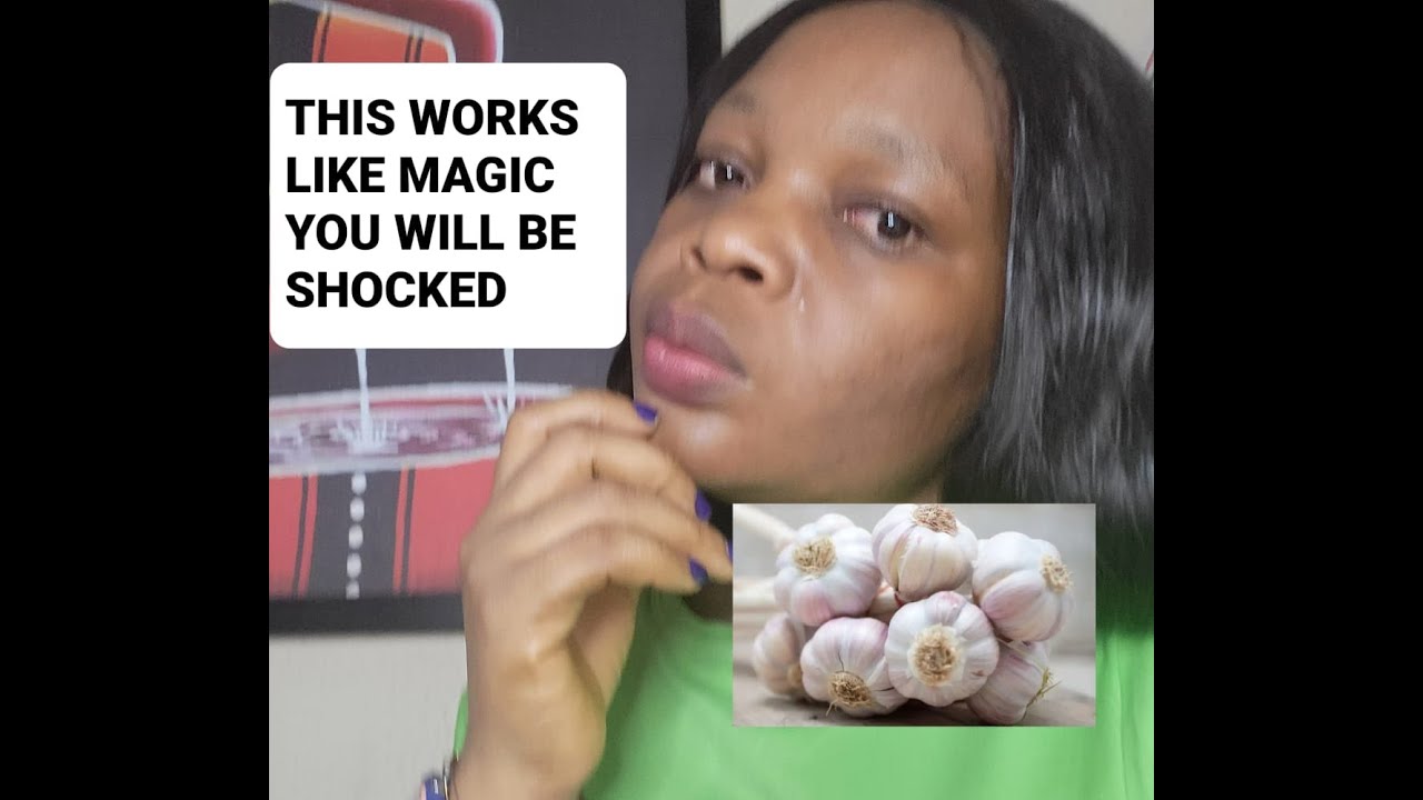 WASH YOUR FACE IN 2 PIECES OF GARLIC WATER AND.... - YouTube