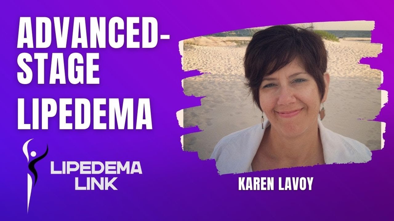 Living with Advanced Stage Lipedema - Karen's Journey to Diagnosis and ...