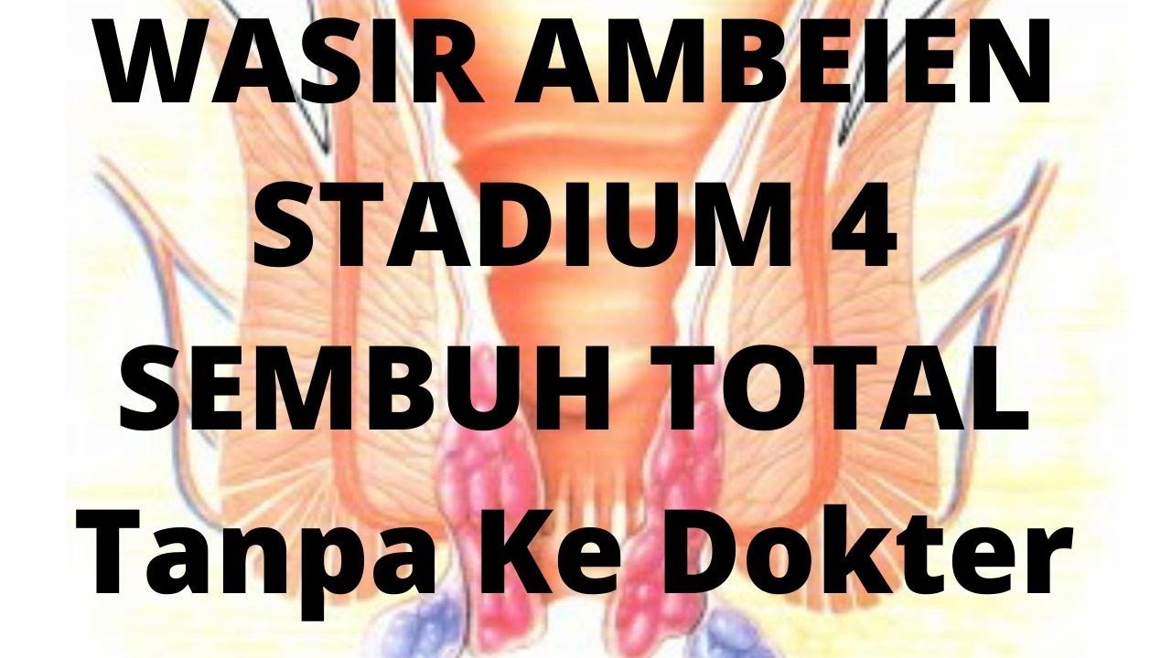 WASIR AMBEIEN STADIUM 4 SEMBUH TOTAL Tanpa Ke Dokter - YouTube