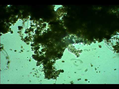 Feeding bdelloid rotifer at 100X - YouTube