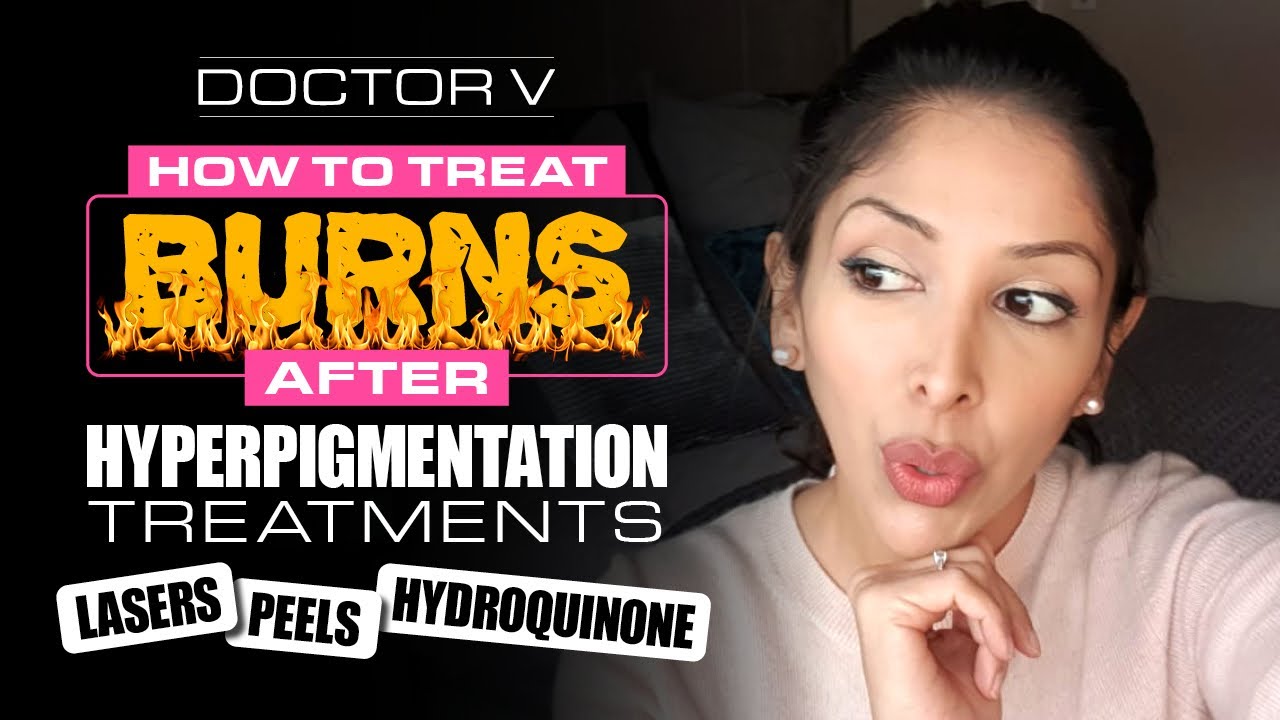 Doctor V - How To Treat Burns after Hyperpigmentation Treatments | Skin ...