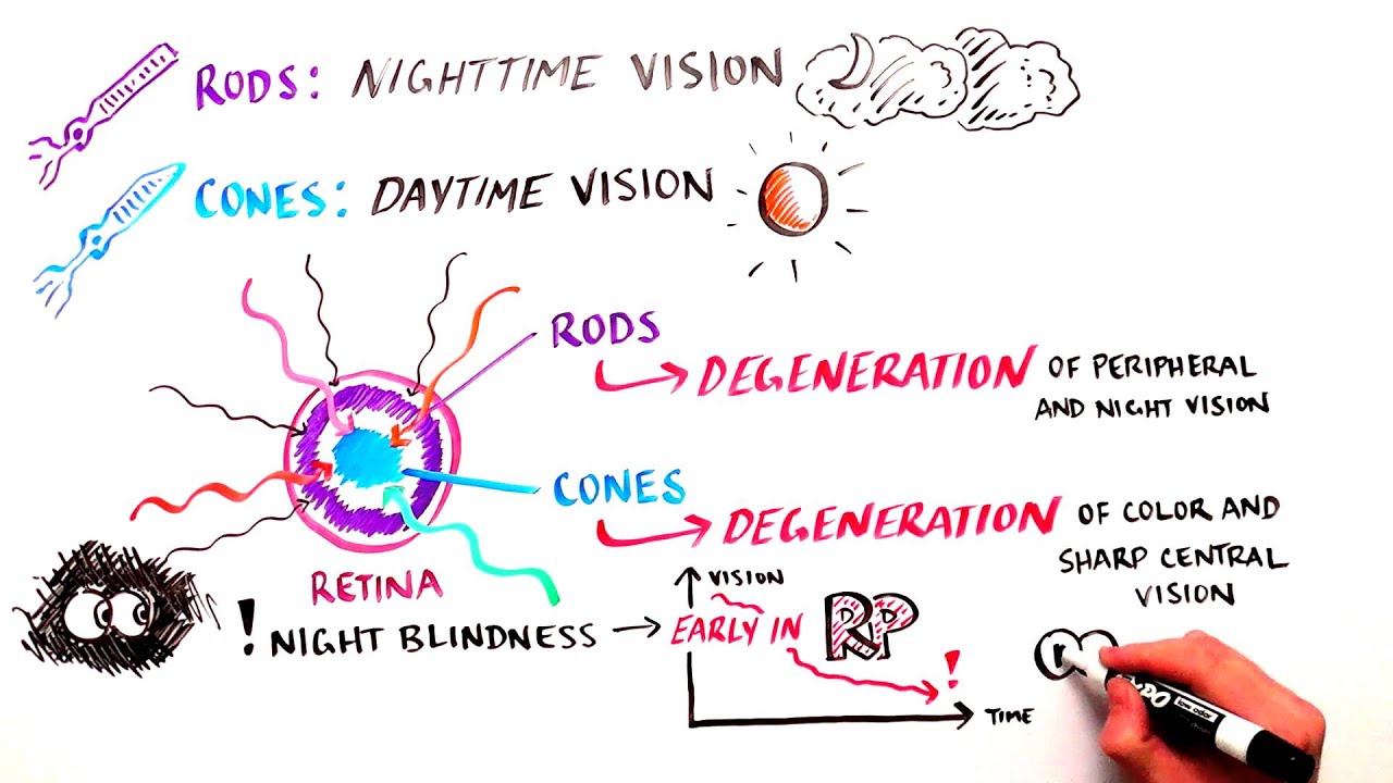 White Board: Retinitis Pigmentosa (RP) - YouTube