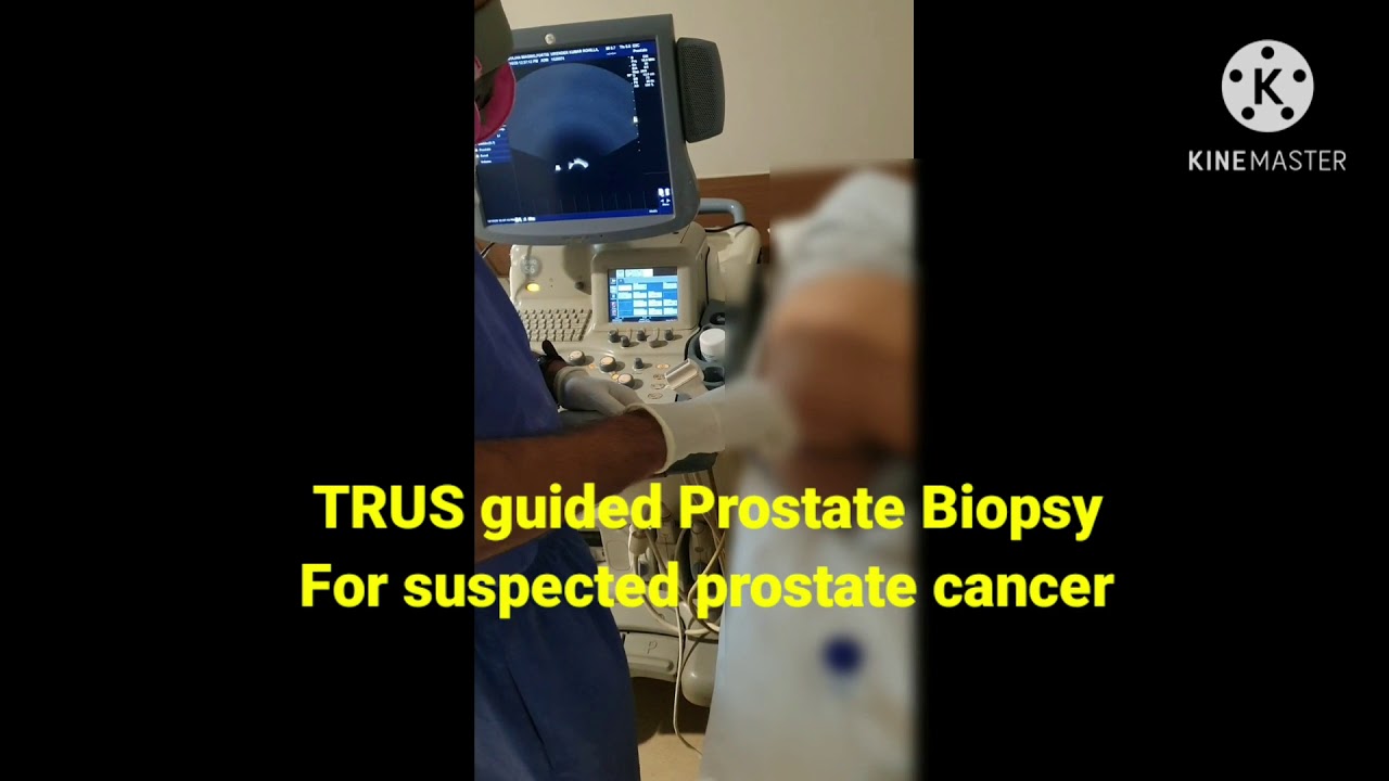 TRUS BIOPSY :prostate biopsy by ultrasound - YouTube