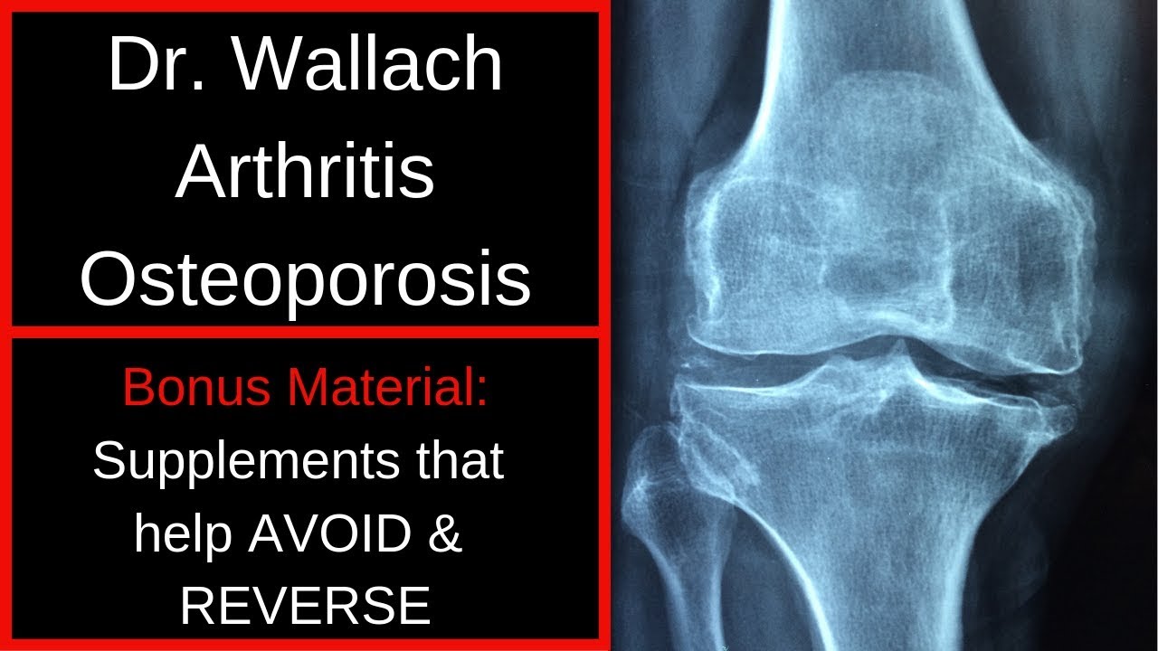 Dr Wallach on Arthritis and Osteoporosis - YouTube