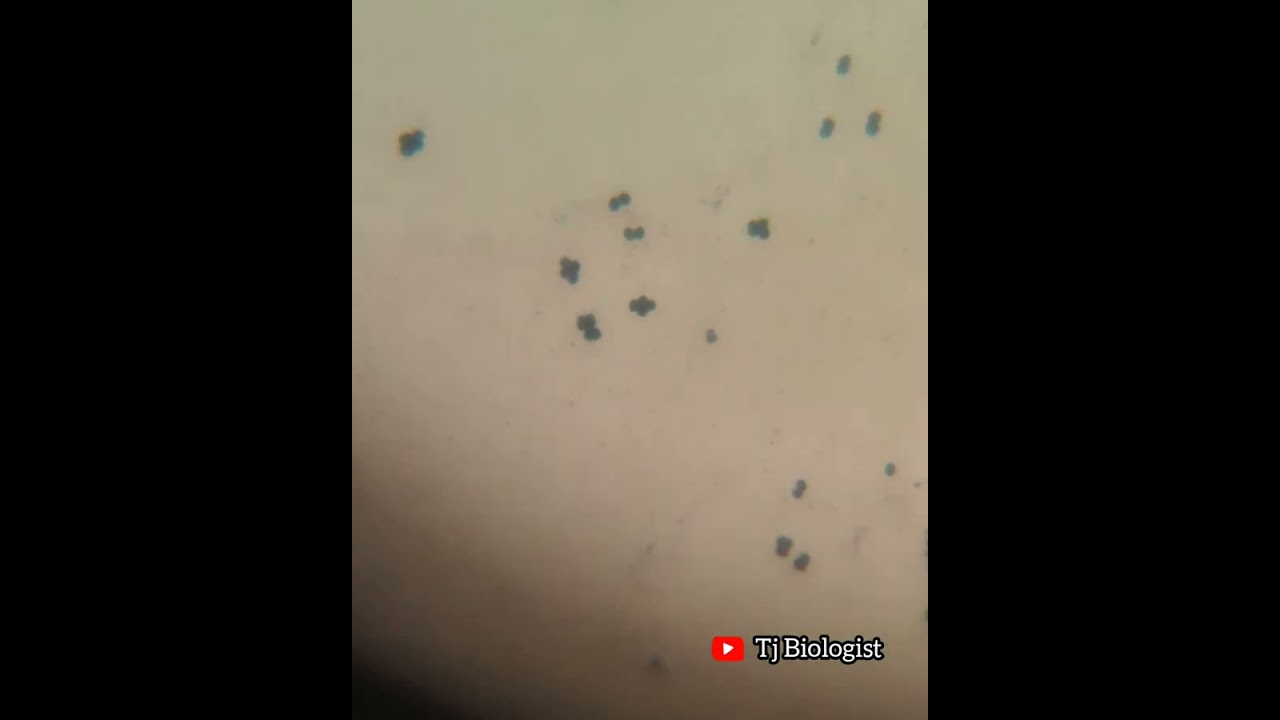 Tetrads | microbiology | Micrococcus | clinical microbiology | gram ...