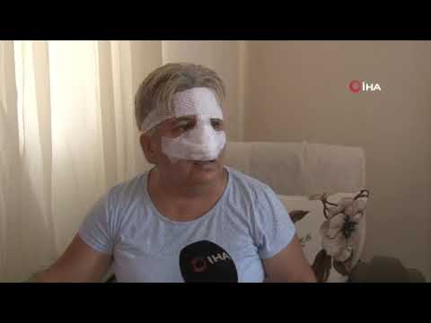 Antalya’da çocuk parkında pitbull dehşeti