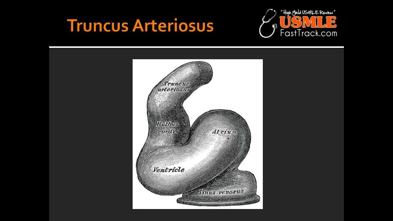 Truncus Arteriosus - YouTube