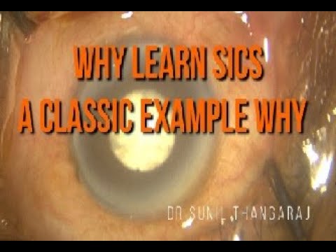 Why learn SICS - YouTube