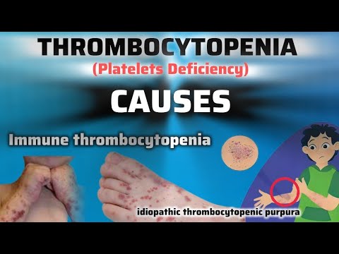 Thrombocytopenia - Low Platelet Count/Platelet Deficiency | Causes ...