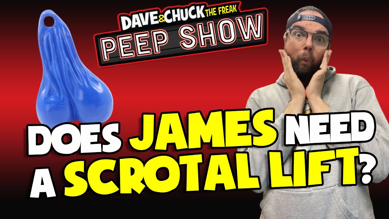 Does James Need A Scrotal Lift Youtube