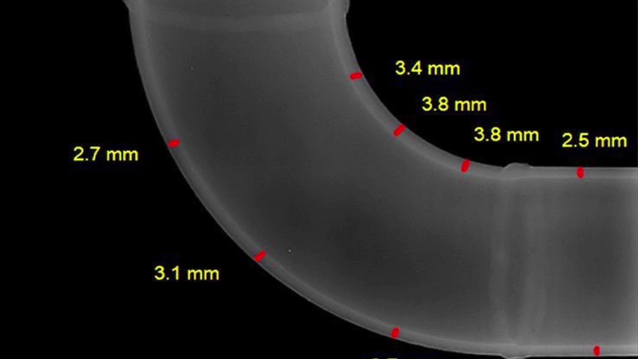 #profile #radiography - YouTube