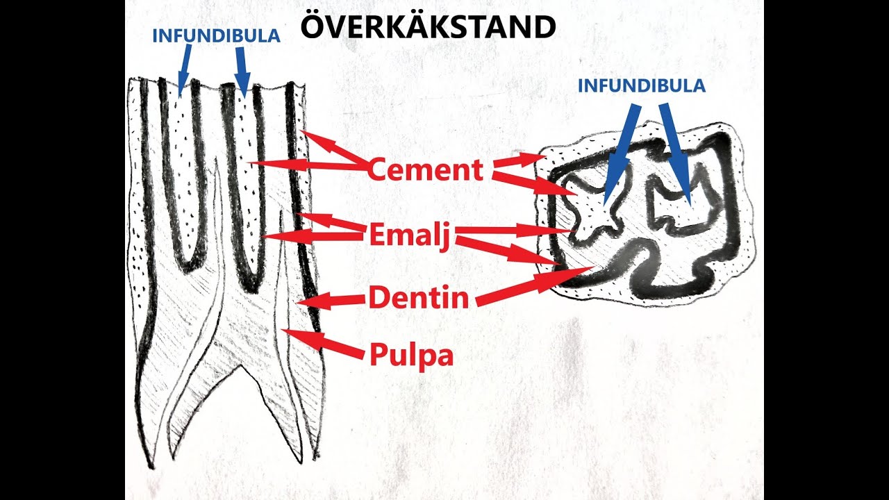 Infundibular KARIES hos HÄST - INFUNDIBULAR CARIES IN HORSE - YouTube