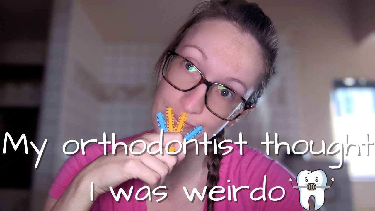 Braces Colors Getting Changed- Yellow & Teal Rubber Bands +Wire Change ...