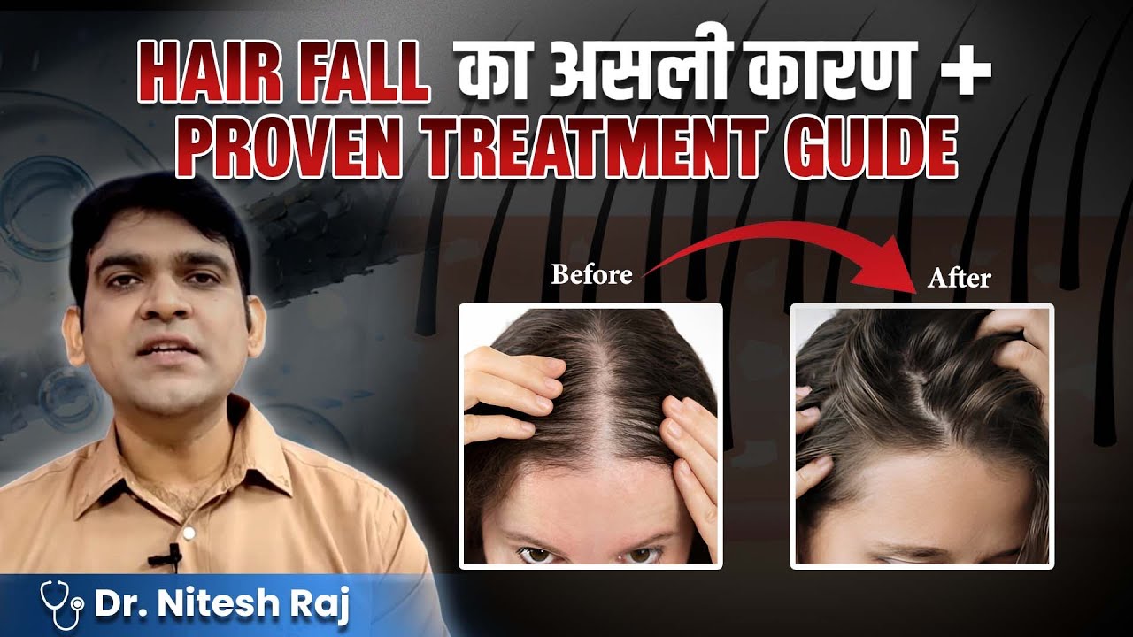 Hair fall/hair loss.Best Multivitamins/Hair supplements for hair fall ...