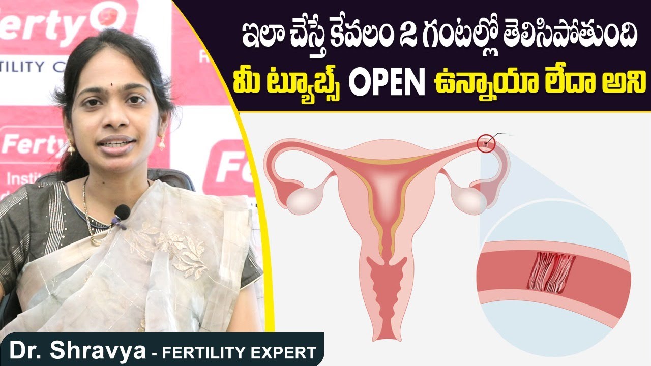 ట్యూబల్ సమస్య || How to Diagnose Tubal Problems Telugu || Best ...