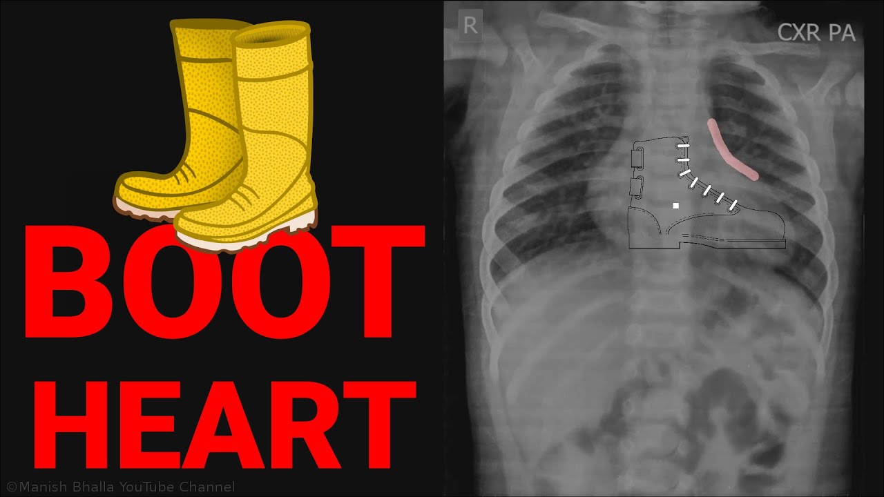 Boot Shape Heart - YouTube