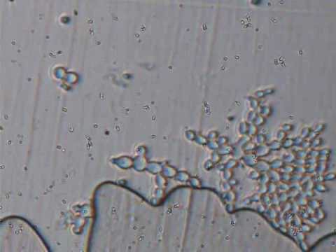 Yeast growth - YouTube