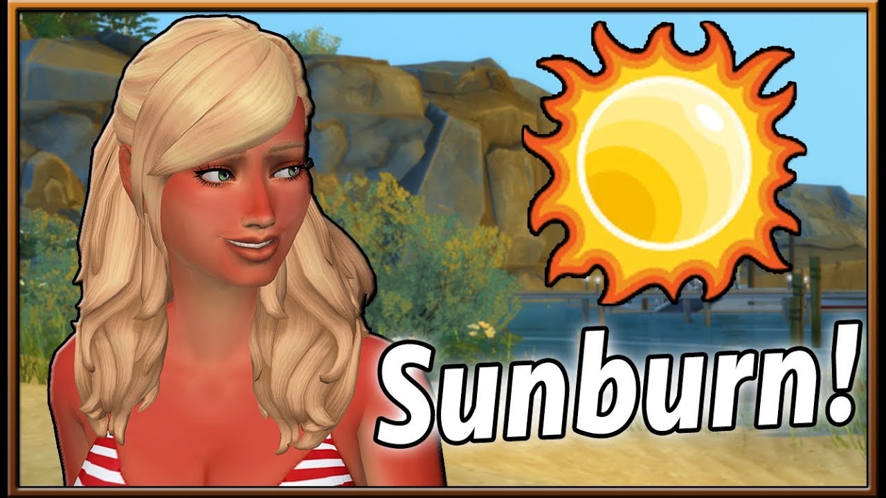 REAL SUNBURN MOD! | The Sims 4 (Created by flerb) - YouTube