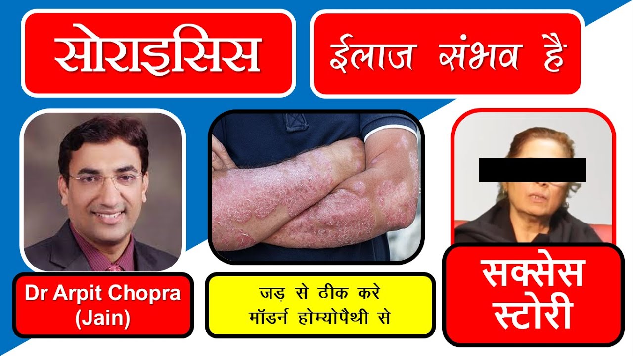 Psoriasis Permanent Treatment |Psoriasis Cure Success Story |Dr. Arpit ...