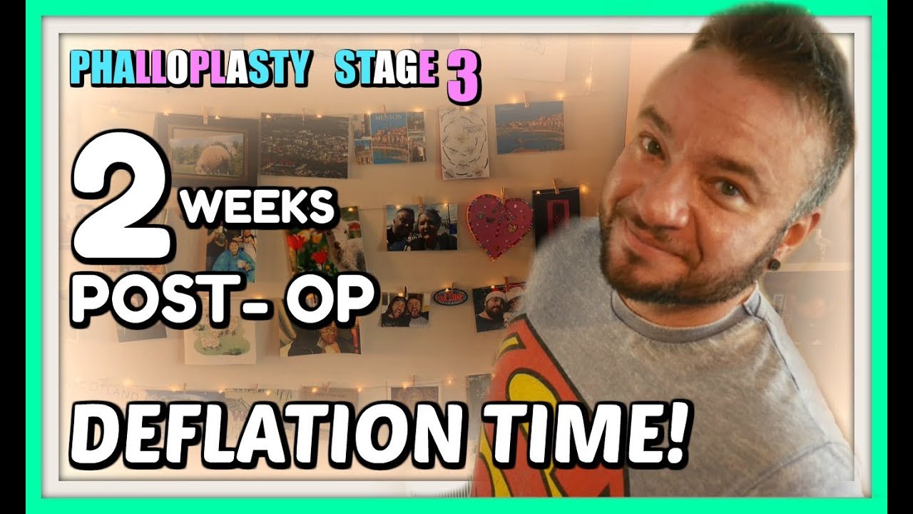 FTM Phallo | Stage 3 - 2 Weeks Post-Op - YouTube