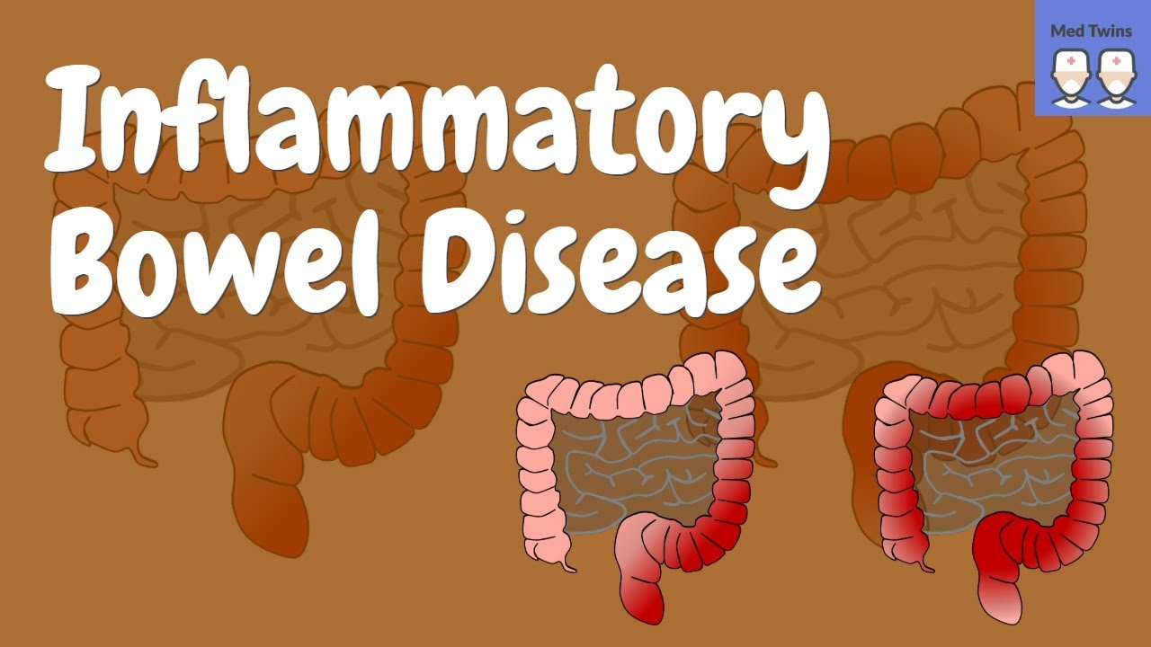 Inflammatory Bowel Disease[Crohn's Disease VS Ulcerative Colitis ...