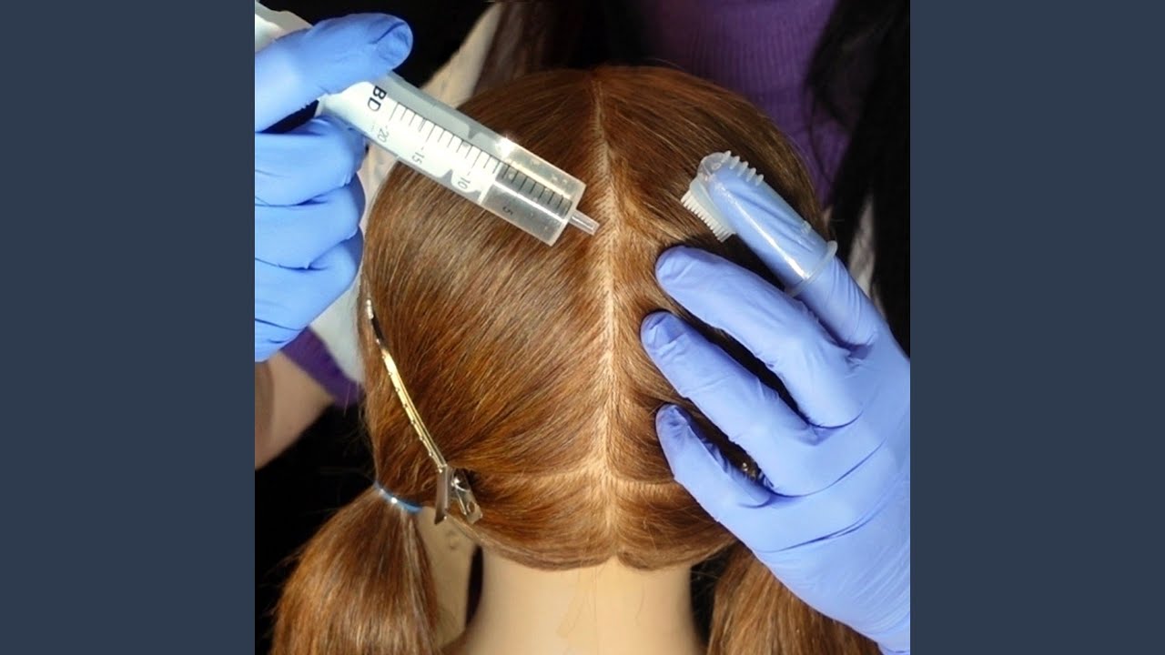 Scalp Check, Pt. 1 - YouTube